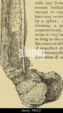 'A System of Surgery' (1895) provides a comprehensive guide to surgical ...