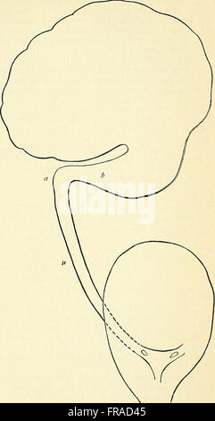 An American Text-Book of Genito-Urinary Diseases, Syphilis and Diseases ...