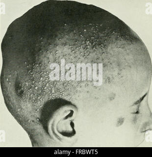 The British Journal of Dermatology (1888) presents research and studies ...