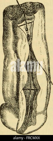 The 1875 'Manual of Pathological Anatomy' provides a comprehensive ...