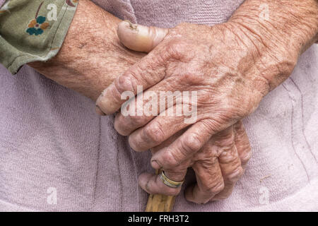 The process of aging of human skin - wrinkled hands of a very old man ...
