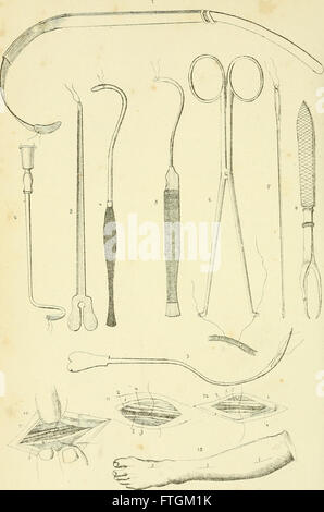 Operative surgery illustrated - containing more than nineteen hundred ...