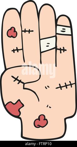 freehand retro cartoon injured hand Stock Vector Image & Art - Alamy