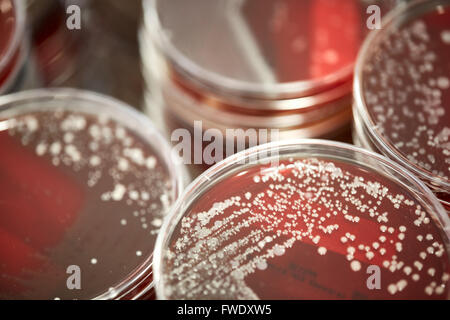 blood plates testing antibiotics liquids samples lab laboratory ...