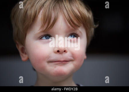 Stye eye infection Stock Photo - Alamy