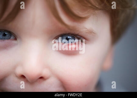 An external stye or sty also hordeolum, is an infection of the ...