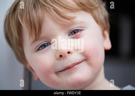 An external stye or sty also hordeolum, is an infection of the ...