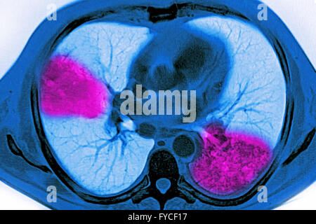 RESPIRATORY TRACT, SCAN Stock Photo - Alamy