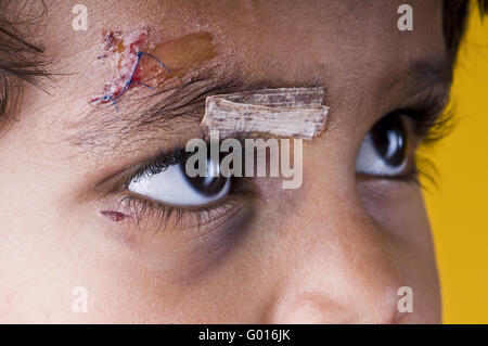 plaster, accident, hurt, injury, cut, bruise, bump, squeeze, head Stock ...