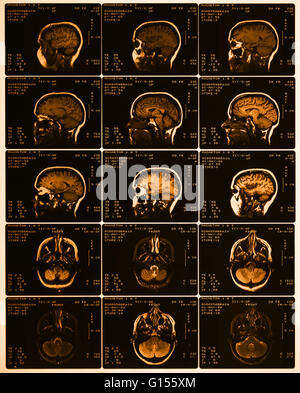 Color enhanced sheet of MRI scans showing showing normal anatomy of the ...