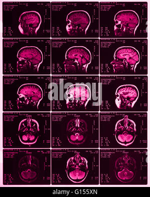 Color enhanced sheet of MRI scans showing showing normal anatomy of the ...