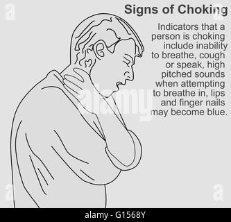 A first aid illustration showing signs of choking. Indicators include ...