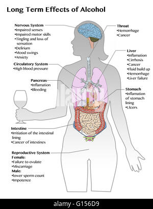 Diagram showing the long-term effects of excess alcohol consumption ...