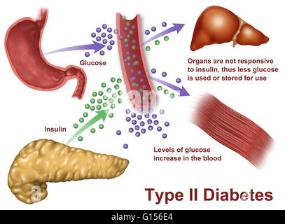 llustration of insulin and glucose production in Type 2 diabetes ...