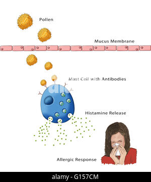 Illustration showing the allergic response to pollen Stock Photo - Alamy