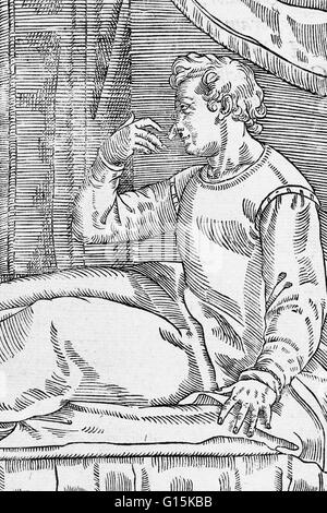 One of Gaspare Tagliacozzi's methods for replacing a missing nose. Here ...