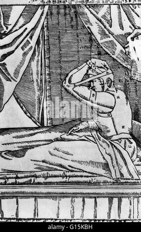 One of Gaspare Tagliacozzi's methods for replacing a missing nose. Here ...