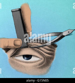 Illustration showing the surgical procedure to correct a lazy lower ...