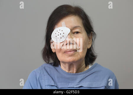 Eye shield covering senior woman after cataract surgery Stock Photo - Alamy