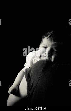 A shoulder to cry on. a baby girl who has a cleft palate looking over ...