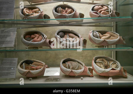 Anatomical models of obstetrics at the Poggi Museum (Museo Poggi) in ...