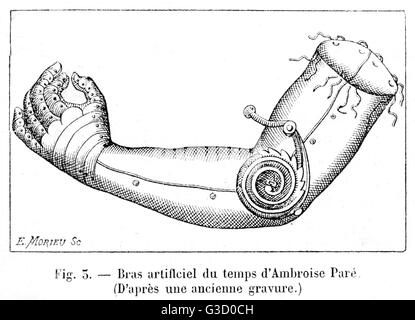 Ambroise Paré (1510-1590) was a French surgeon, anatomist and Stock ...