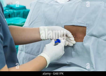 spinal nerve block Stock Photo - Alamy
