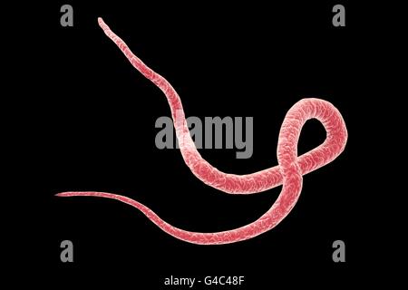 Illustration of an infection of Ascaris lumbricoides parasitic ...