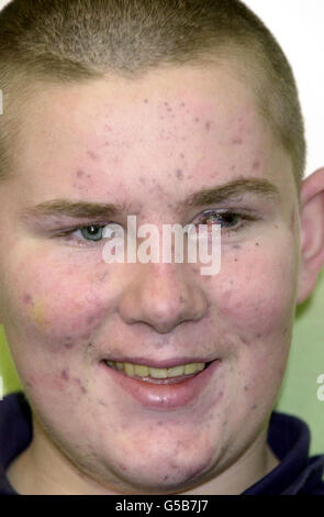 Stephen Menary the 14 year old boy who was badly injured by a terrorist ...