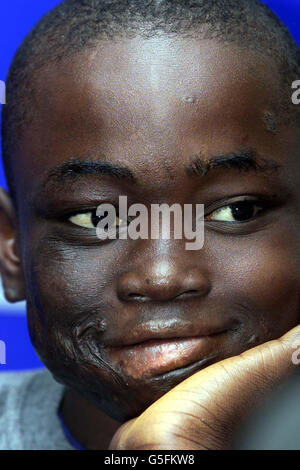 Issa Kamara,10, from Sierra Leone, during a press conference in Norwich ...