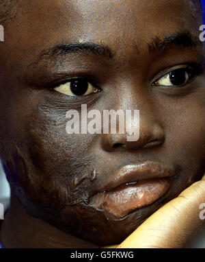 Issa Kamara,10, from Sierra Leone, during a press conference in Norwich ...