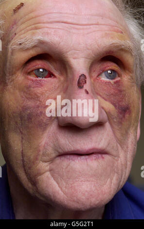 John Gilmartin/ youth attack Stock Photo - Alamy