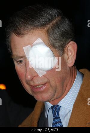 Prince Charles Eye Patch Stock Photo: 106746664 - Alamy