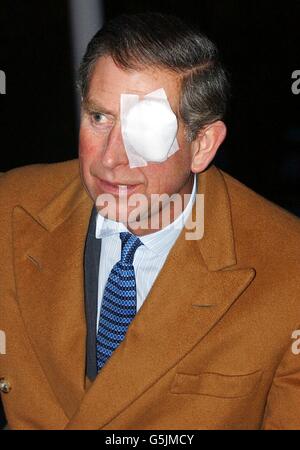 Prince Charles Eye Patch Stock Photo: 106746664 - Alamy