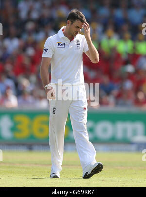 England bowler James Anderson shows off his newly shaved head during ...