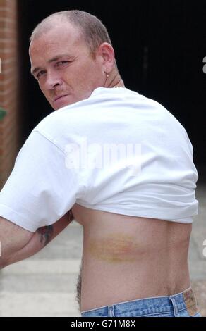 Peter Barwick, 37, in Teesside, where he was showing injuries he ...
