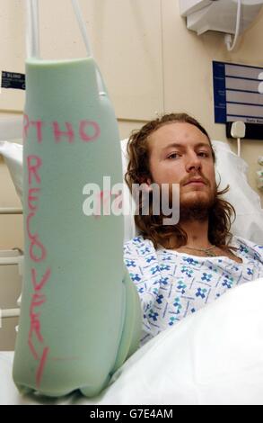 Rail crash survivor 21-year-old Jon Stace of London at the Royal ...