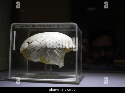 s Forensics: The anatomy of crime exhibition in central London Stock ...