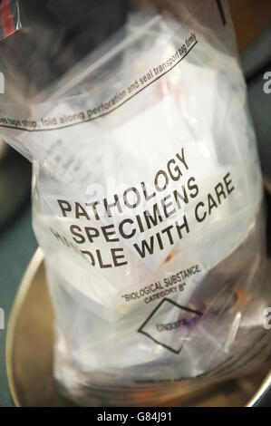 Pathology specimens. Collection of pathology specimens Stock Photo - Alamy