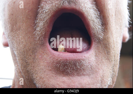 Mouth without teeth Stock Photo - Alamy