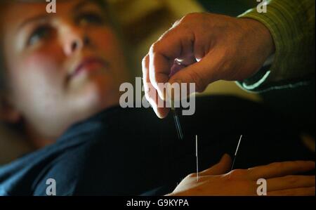 Acupuncture is a system of medicine using the insertion of needles into ...