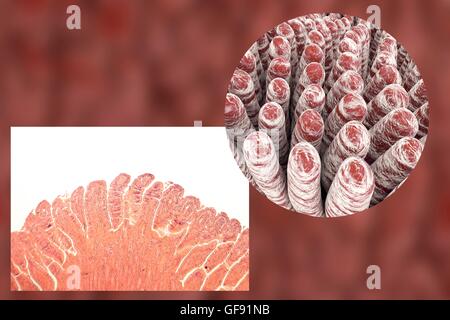 Intestinal villi, computer illustration. Villi are finger-like ...