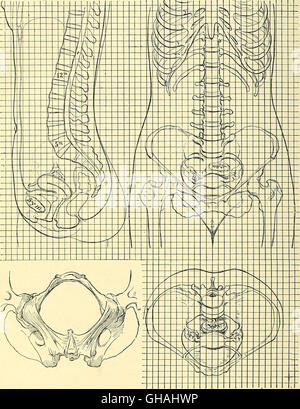 This 1906 textbook covers surgical procedures in gynecology, providing ...