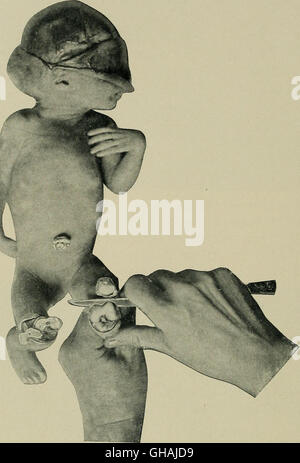 *Postmortem Pathology* (1906) provides a detailed guide on performing ...