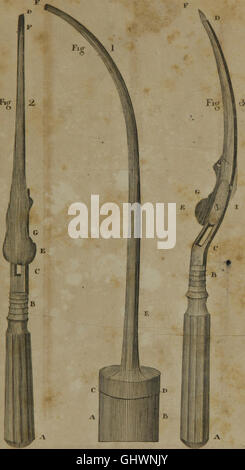 Volume 4 of 'A System of Surgery' (1804) covers advanced surgical ...