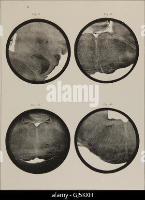 . The gray substance of the medulla oblongata and trapezium. Posterior ...