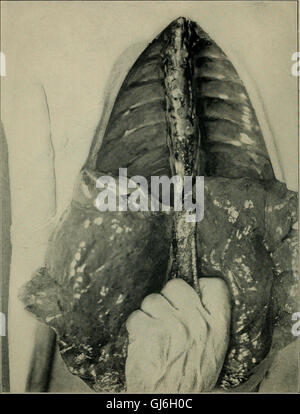 'Postmortem Pathology' (1906) is a manual detailing the procedures for ...