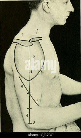 "Landmarks and surface markings of the human body" (1913 Stock Photo ...