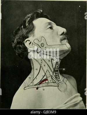 "Landmarks and surface markings of the human body" (1913 Stock Photo ...