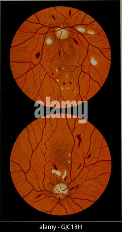 This 1910 atlas provides a comprehensive guide to ophthalmoscopy, a ...